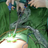 hernia-center.com.tw - /ct/sqss/